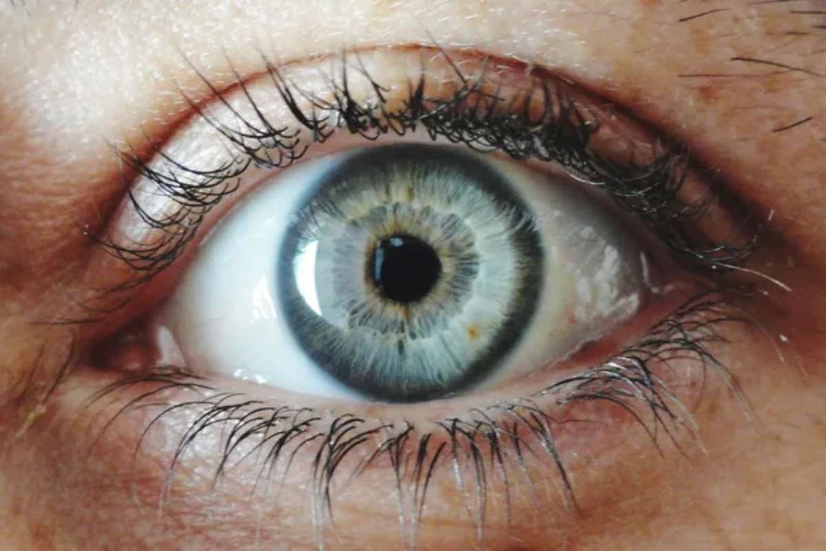 7 Rarest Eye Colors in the World- Nature’s Most Unique Shades | CIO ...